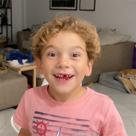 Dad Removes Sons Tooth With Baseball