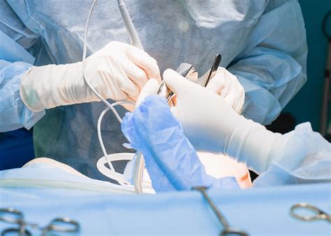 Gingivitis Gum Disease Causes Symptoms And Treatment