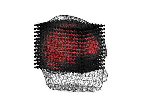 Forward Modeling For Eeg Source Reconstruction Fieldtrip Toolbox