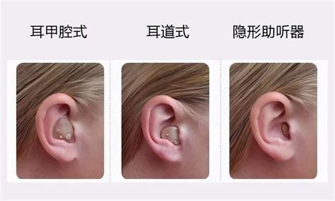 助听器的分类 每日头条
