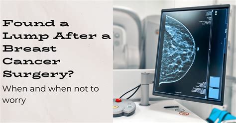 How Often Are Breast Biopsies Cancer At Lowell Morris Blog