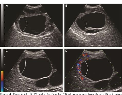 Ovulation Follicle
