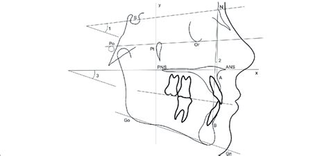 Schematic Illustration Of The Skeletal Variables Considered In The Download Scientific Diagram