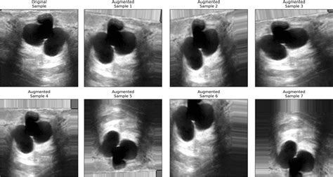 Graphical Illustration Of Some Of The Data Augmentation Da Methods