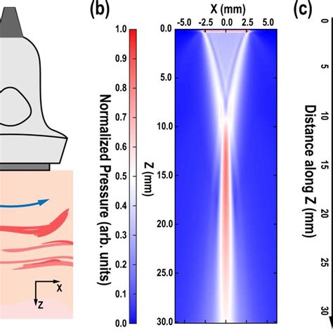 Principles Of Ultrasonography A Illustration Of The Pulse Echo Imaging Download Scientific