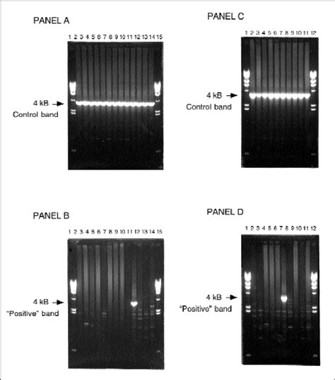 Identification Of Targeted Es Clones Using Long Distance Pcr Panel A