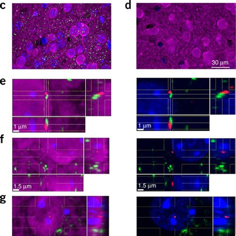 Transneuronal Propagation Of Mhtt In Vivo A Low Magnification Image