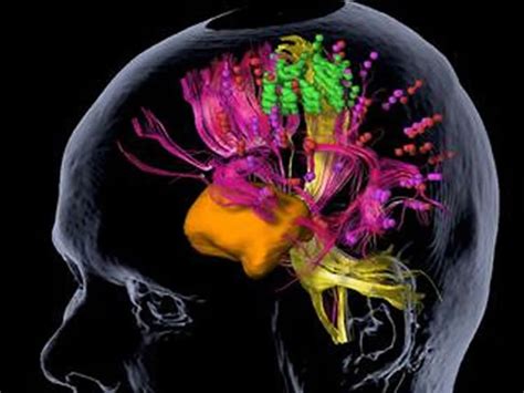 Mapping Motor Areas Improves Prognosis Of Patients With Malignant Brain
