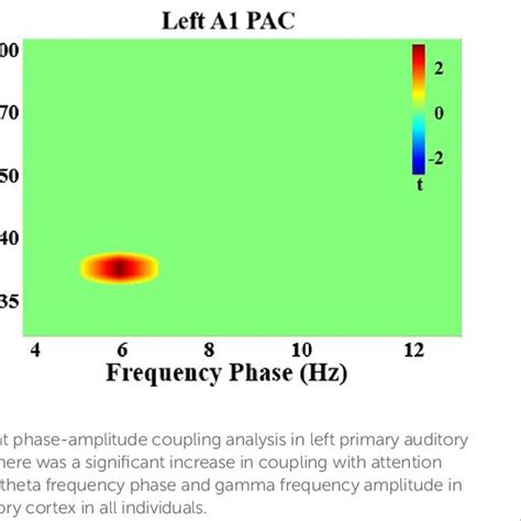 Phase Amplitude Coupling In Auditory Cortex Download Scientific Diagram