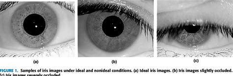 Figure 1 From An Adaptive Cnns Technology For Robust Iris Segmentation