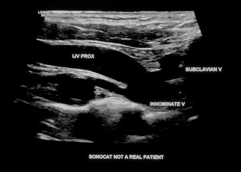 Sonocat Practical Guide To General Sonography