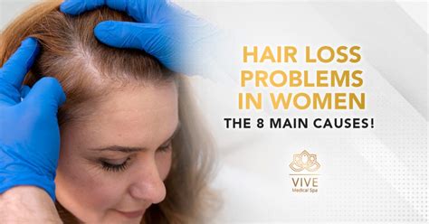 Why Do Women Lose Hair Vive Medical Spa