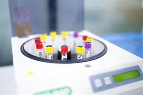 What Is Elution In Chromatography——one Article To Know All