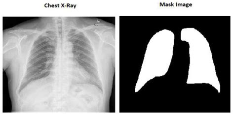 Deep Neural Network For Lung Image Segmentation On Chest X Ray