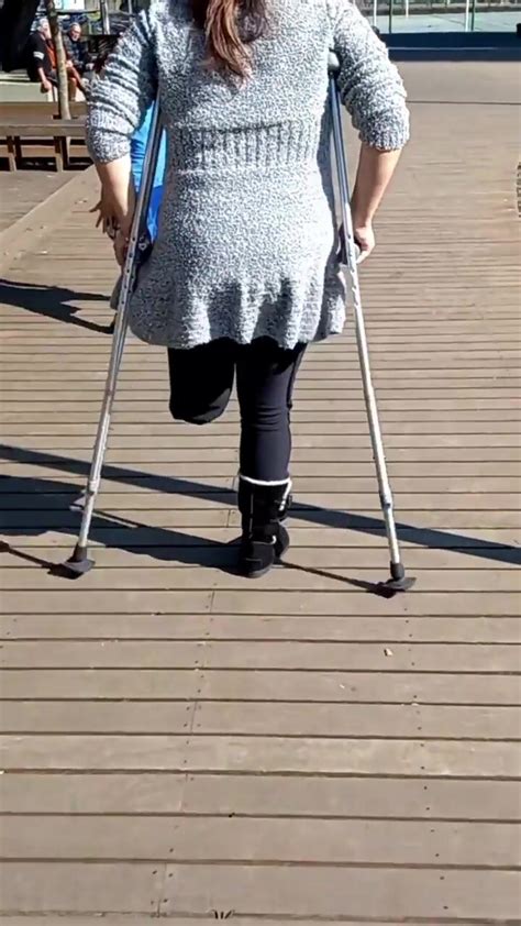 Amputee Women In Crutches Video 8