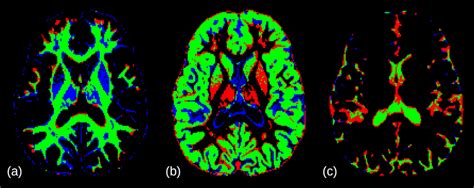Axial Slice Of The Brain Showing Voxels Classified Differently As A