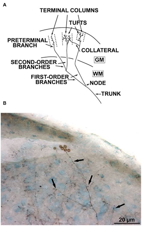 Architecture Of The Callosal Axons A Schematic Drawing Of A Terminal Download Scientific