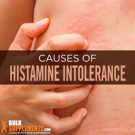 Histamine Reaction On Skin