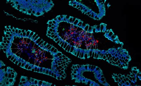 Quantitative Digital Pathology An Overview Of The Halo® Image Analysis Platform Indica Labs