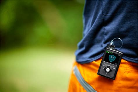 Medtronic Thyroid Ablation Rfamd