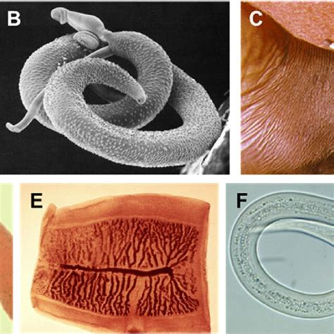 Examples Of Human Helminths A Female Ascaris Lumbricoides Large