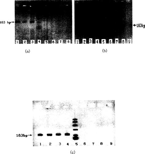 Pcr Amplification Primer Kit And Use Thereof In Identification Of Mammal Sex Eureka Patsnap