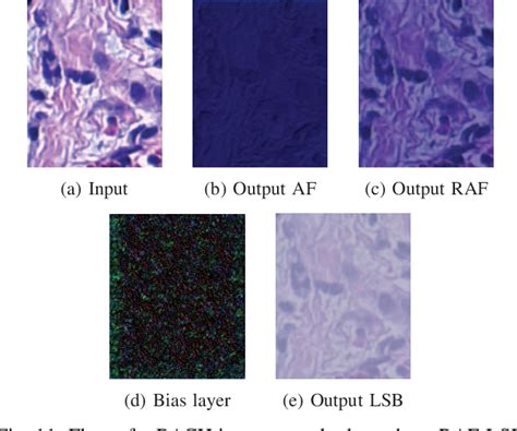 Figure 11 From Improving Histopathology Classification Using Learnable