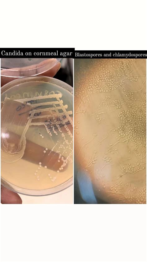 Priyanka Yadav On Linkedin Asexual Spores Called Blastoconidia