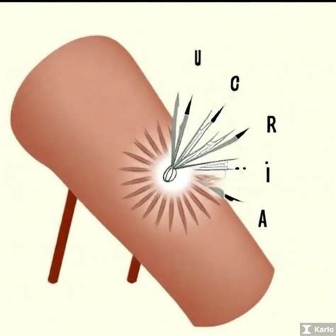 무릎통증 완화를 위한 효과적인 지압 포인트