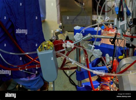 Cardiopulmonary Bypass Cpb Machine Connected And In Use Also Known