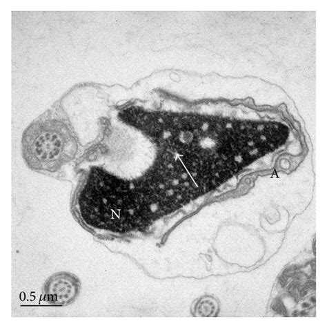 A B C And D Spermatozoa From Normal Sperm Samples With