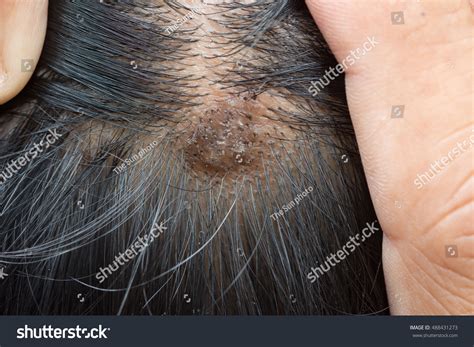 Skin Disease Head