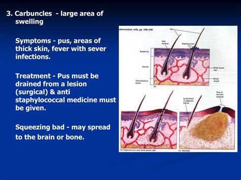 Ppt Skin Functions Anatomy And Diseases A Comprehensive Guide