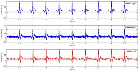 Traitement du Signal Matlab Filtrage numérique Analyse du