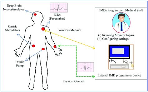 Proposed Raspberry Pi Implemented With MATLAB Simulation And