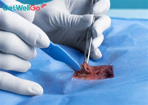 Understanding Penis Enlargement Surgery And Its Risks