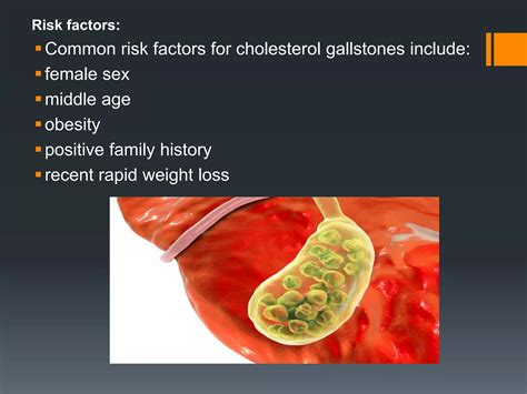 Gallbladder Ultrasound Basic Pptx