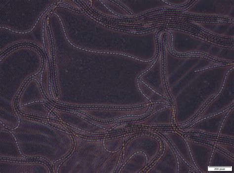 Please Can Anyone Identify This Algae In My Photo Researchgate