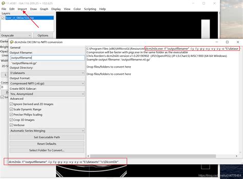使用dcm2niix将dicom文件转为niigz格式 Csdn博客