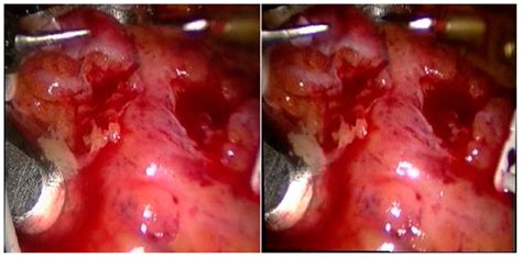 Three Dimensional Point Cloud Reconstruction Method Of Cardiac Soft