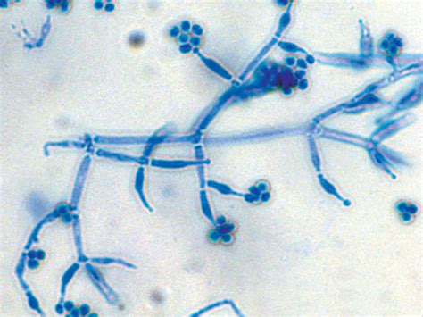Trichoderma Mycology University Of Adelaide