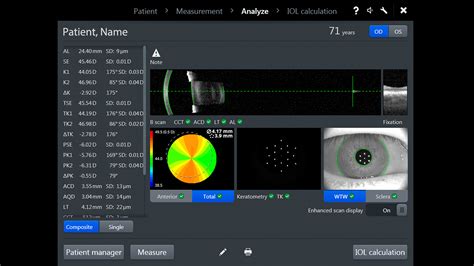 Astigmatism Visualization And Precise Measurement