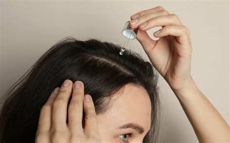 Scalp Acne Causes Treatments And Prevention The Derm Spot