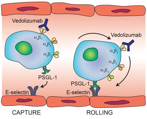 Biologics Ulcerative Colitis Healio