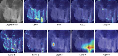 Figure 2 From Visualization Of Layers Within A Convolutional Neural