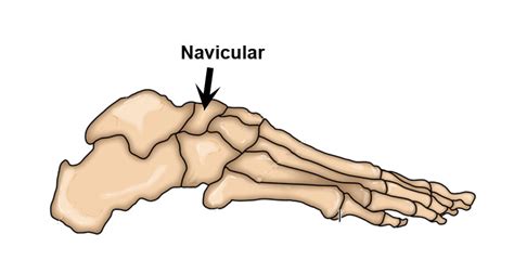 Medial Calcaneal Nerve Entrapment Symptoms And Treatment