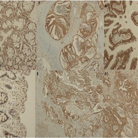 A Weak Cytoplasmic Akt Staining In A Normal Colon Mucosa ×100 Ihc Download Scientific