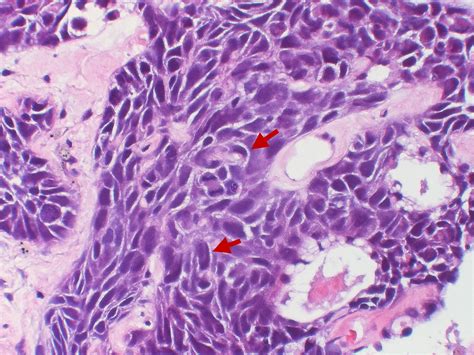 Intercellular Bridges