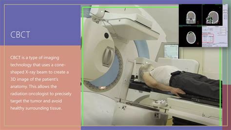 Igrt Image Guided Radiotherapy Technique Pptx Cancer Diseases And Conditions