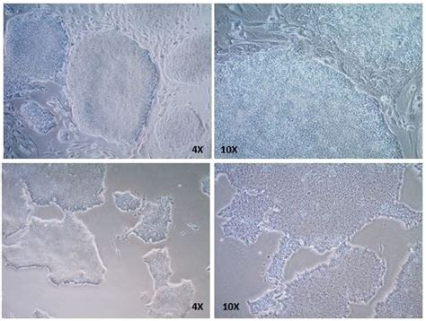 Passaging Human Ips Cells Protocol Using Ez Lift™ Reagent